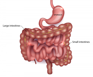 Dysmotility: Causes, Types, and Treatments | Colon & Rectal Surgical ...
